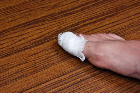 Photo of Ingrown toenail disease blood - ID:1-21511660 - Royalty Free ...