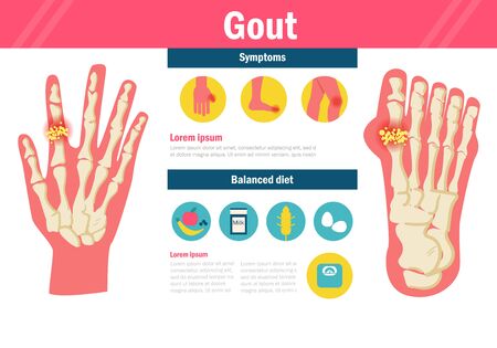 Vector of Gout Vector. Cartoon. Isolated - ID:1-131592507 - Royalty ...