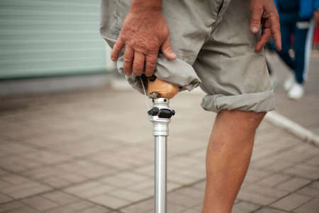 Photo of Metal prosthetic leg. Simple - ID:1-155860629 - Royalty Free ...