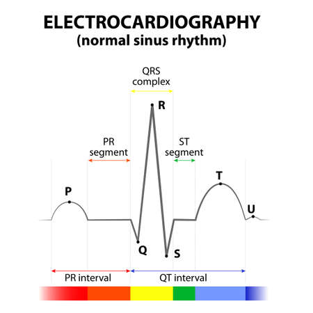 Vector of ECG of a heart in normal sinus - ID:1-50144835 - Royalty Free ...