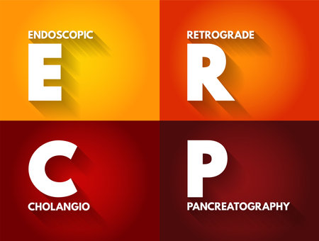 Vector of ERCP Endoscopic Retrograde - ID:1-198778840 - Royalty Free ...