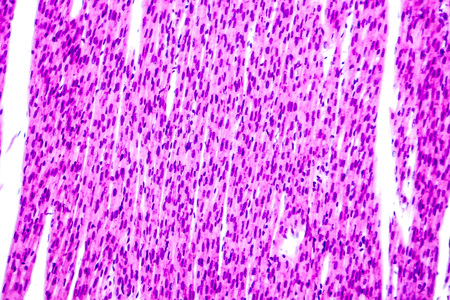 Photo of Heart muscle, light - ID:1-63437134 - Royalty Free Image ...