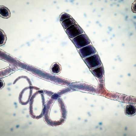 Photo of Fungi Trichophyton - ID:1-186519892 - Royalty Free Image ...