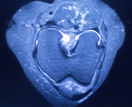 MRI magnetic resonance imaging medical scan test results showing ...