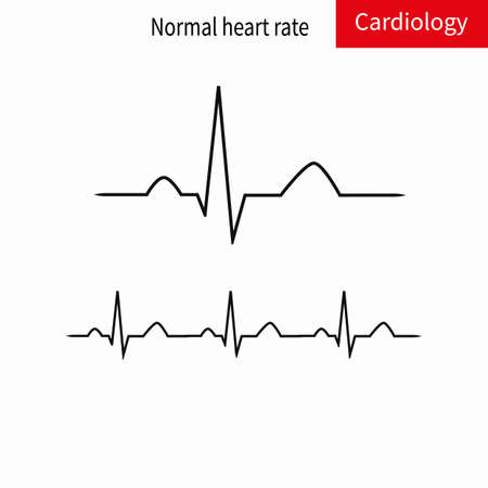 Vector of Normal and pathological ecg - ID:1-125570461 - Royalty Free ...