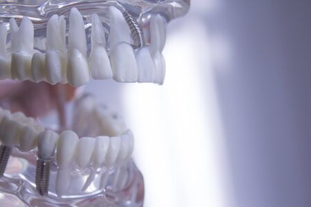 False teeth sample for dentists - Stock Image - Everypixel