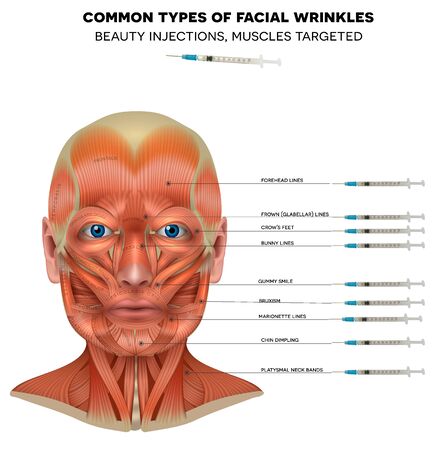 Vector of Facial injections info poster, - ID:1-140557797 - Royalty ...