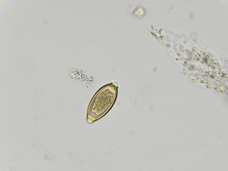 Egg of Trichuris trichiura in stool, analyze by microscopeの写真素材 ...