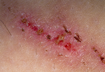 Scratches the skin Images - Search Images on Everypixel