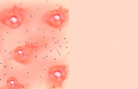 Vector of Texture, inflamed pimples and - ID:1-143887601 - Royalty Free ...