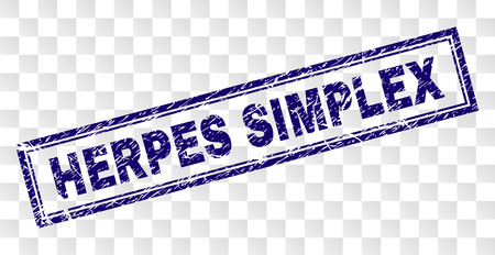 Vector of HERPES SIMPLEX stamp seal - ID:1-125583086 - Royalty Free ...