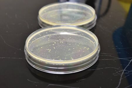 Many petri dishes with culture medium for microbiology laboratory ...