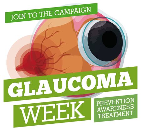 Vector of Poster for Glaucoma Week with - ID:1-150311637 - Royalty Free ...