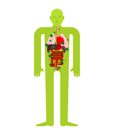 Vector of Sick internal organ Anatomy of - ID:113077290 - Royalty Free ...