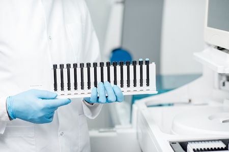 Laboratory assistant holding test tubes near the analizer machine at ...