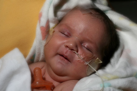 smiling, sleeping newborn baby in the ICUの写真素材 [40000466231] - イメージマート