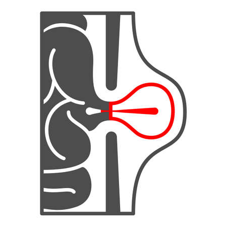 Vector of Inguinal hernia solid icon, - ID:1-167125372 - Royalty Free ...