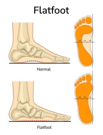 Vector of Illustration of a normal foot - ID:1-183550594 - Royalty Free ...