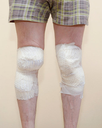 Knees bleeding Stock Images - Search Stock Images on Everypixel