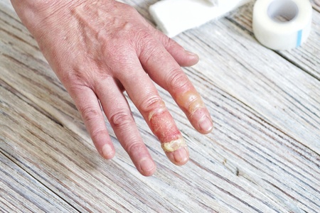 Photo of Woman puts scalded hand into - ID:1-116458992 - Royalty Free ...