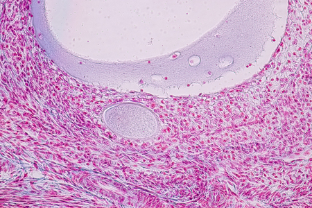Education anatomy and Histological sample Ovary of rabbit Tissue under ...