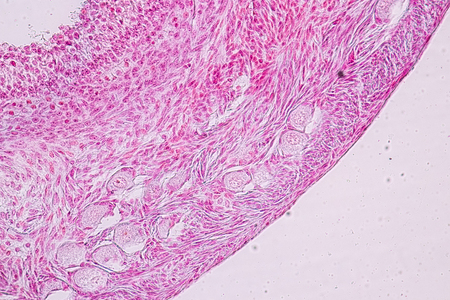 Education anatomy and Histological sample Ovary of rabbit Tissue under ...
