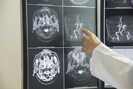 Doctor pointing a finger to the anatomy on brain MRI image in radiology ...