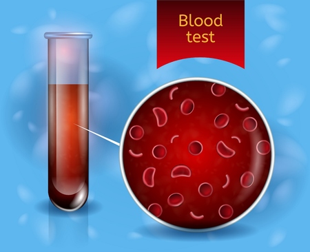 Blood Test Vector Concept or Poster with Extracted Arterial or Venous ...