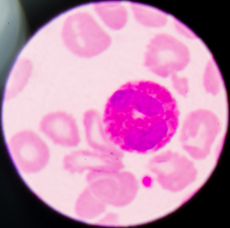 Photo de White blood cells of a human, - ID:40636478 - image libre de ...