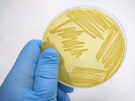 Culture medium agar Images - Search Images on Everypixel