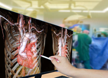 Close up hand Doctor point the computer monitor during heart operation ...
