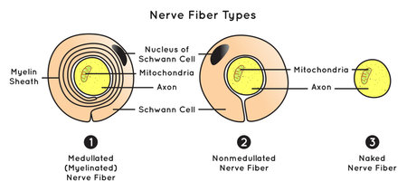 Vector of Nerve Fiber Types Infographic - ID:1-182006216 - Royalty Free ...