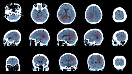 Photo of MRI scan brain, ct scan of - ID:1-108200038 - Royalty Free ...