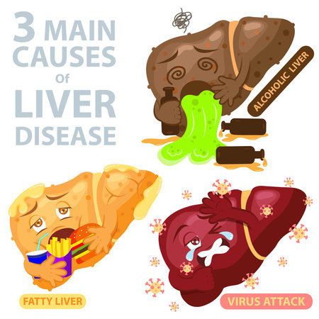 Vector of the 3 main causes of liver - ID:1-195928514 - Royalty Free ...