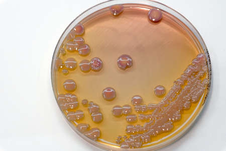 Klebsiella pneumoniae or Klebsiella spp.; bacterial culture growth on ...