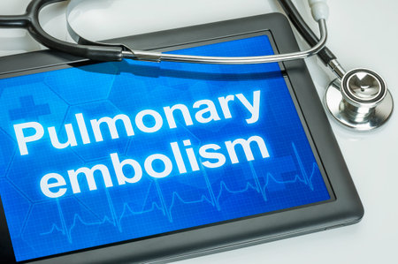Tablet with the text Pulmonary embolism on the display - Stock Image ...